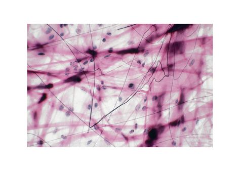 Connective Tissue Diagram Quizlet