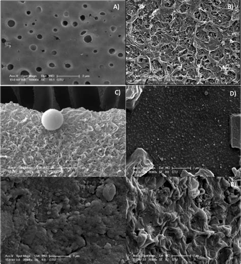 Sem Micrographs Of The Membranes A Surface Of Polysulfone Base Download Scientific Diagram