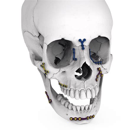 Cmx Precision App Pedidos Sampedro