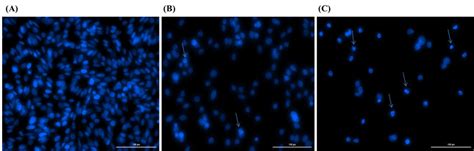 Representative Photograph Showing DAPI Staining Of Untreated Control Download Scientific