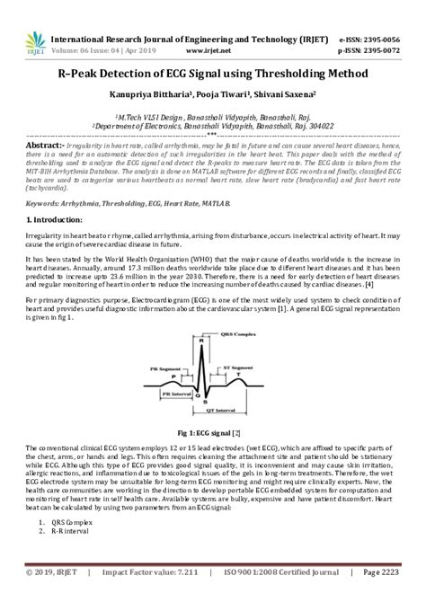 Pdf Irjet R Peak Detection Of Ecg Signal Using Thresholding Method