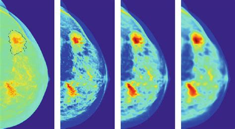 different pre processing results to show the influence of the σ