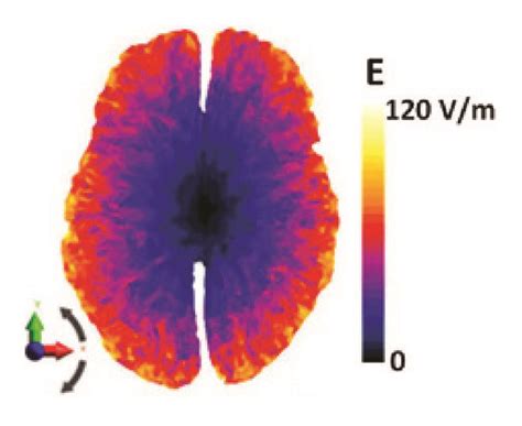 Electric Field Absolute Value In Vm Distribution In The Gm Left Download Scientific Diagram