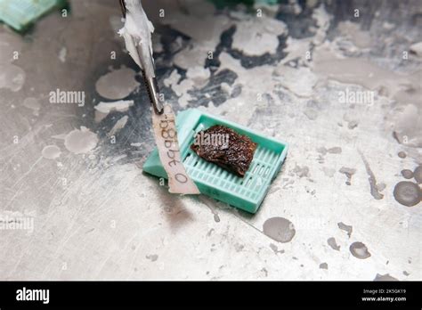 Label Used To Identify The Biopsy Sample Scientist Embedding Tissues In Paraffin Blocks For