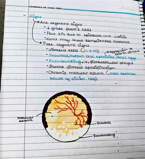 Intermediate Uveitis Understanding The Clinical Signs