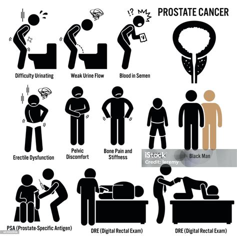 Prostatacancer Symtom Orsakar Riskfaktorer Diagnos Streckfigur Piktogram Ikoner Vektorgrafik Och