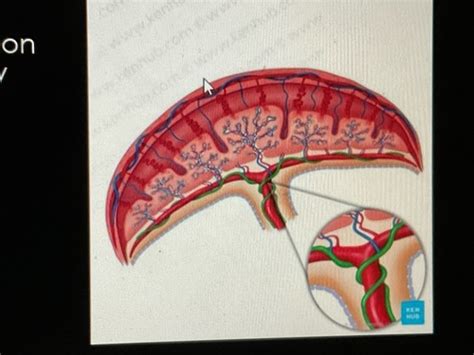 First Trimester Complications Flashcards Quizlet