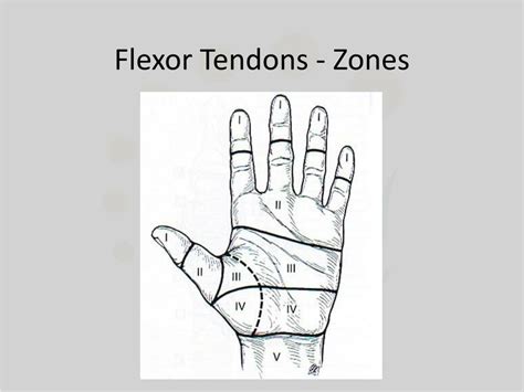 Flexor Tendons Hand