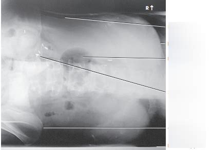 Left Lateral Decubitus Abdomen X Ray Diagram Quizlet