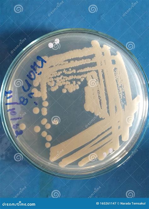 Yeast On Pda Agar Plate Frontside And Behideside Stock Image Image Of Frontside Plate 165261147