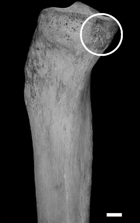 An Approximate Medial View Of A Modern Human Right Proximal Tibia