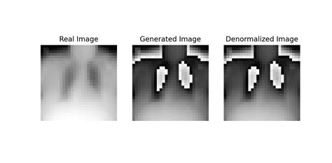 Github Morganbenavidez Lungan Project Aimed At Generating Chest X Ray Images From Low Data