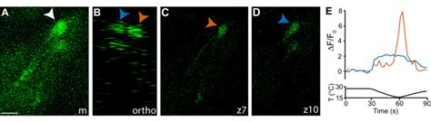 video taci an imagej plugin for 3d calcium imaging analysis