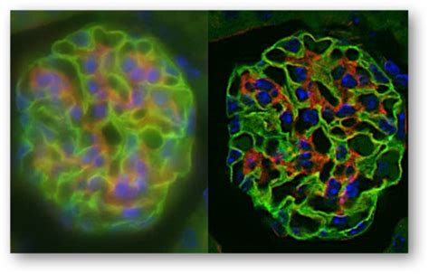 Chapter Observing Microorganisms Through A Microscope Flashcards Quizlet