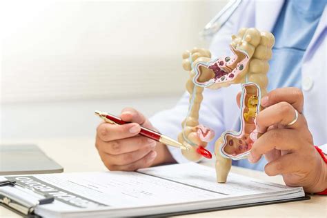 Appendicitis Causes Symptoms Treatment And Recovery Guide