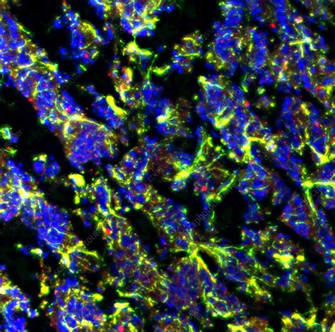 Astrocyte Cells Fluorescence Micrograph Stock Image C051 7993 Science Photo Library