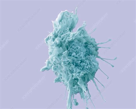 Dendritic Cell Sem Stock Image P266 0085 Science Photo Library