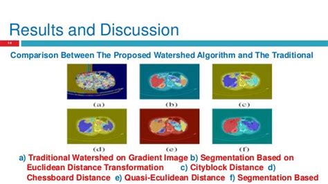 Ns Ws Liver Paper Ica Hybrid Segmentation Approach Based On Neutrosop