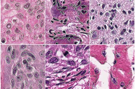 Randomly Selected Examples Of Nucleus Segmentation Results Green Download Scientific Diagram