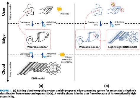 Figure 1 From Automated Arrhythmia Classification System Proof Of