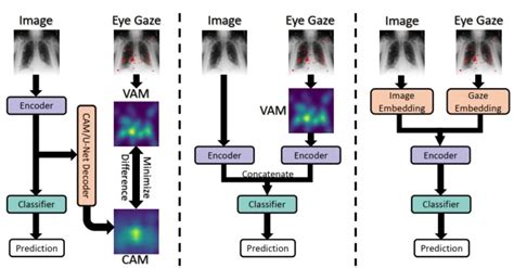gazegnn a gaze guided graph neural network for chest x ray