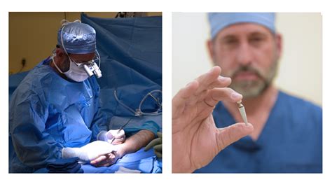 Thumb Joint Replacement Lexington Clinic