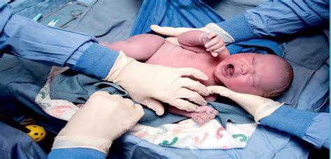 Neonatal Resuscitation Program NRP Gulf CPR