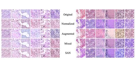 Color Adjusting Technique For Histopathology Image Datasets Could Help Empower Machine Learning