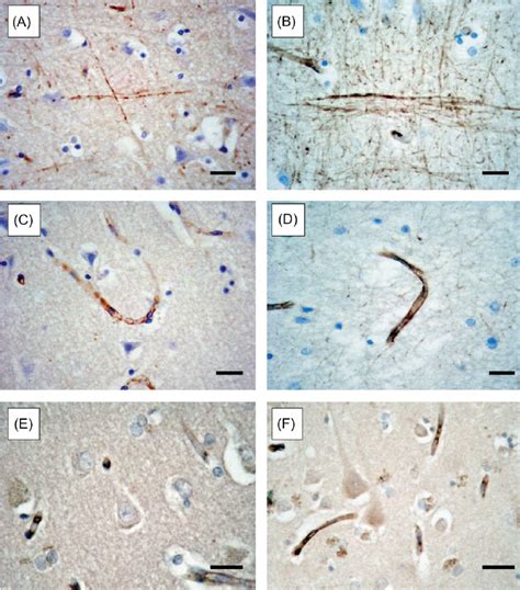 differential immunohistochemical staining in axons capillaries and