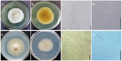 Frontiers Biological Characteristics And Genetics Differentiation Of