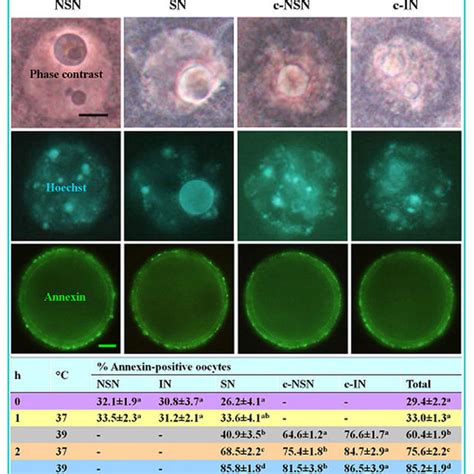 Gv Chromatin Configurations Of Mouse Oocytes Before 0 H Or Following Download Scientific