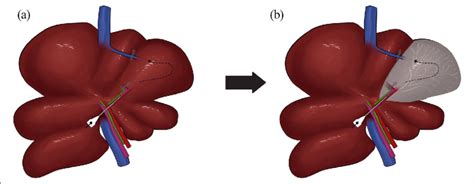 Schematic Representation Of An In Vivo Decellularization Strategy With
