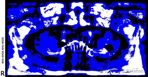 【图像分割】基于合作半监督模糊聚类方法实现自动医学图像分割附matlab代码胃镜分割分类代码复现 Csdn博客