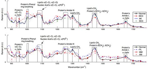 Mean Raman Spectra Acquired In Vivo For Basal Cell Carcinoma Bcc