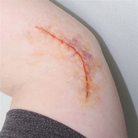 Medium Suture Wounds Set Of Three Silicone Prosthetics Etsy UK In 2023 Prosthetics