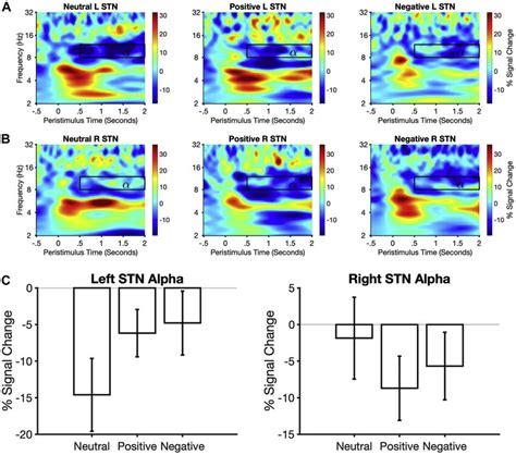 Subthalamic Local Field Potential Activity To Affective Imagery Download Scientific Diagram