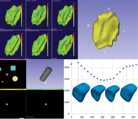 Discovering High Dimensional Biomarkers Using Statistical Shape Analysis
