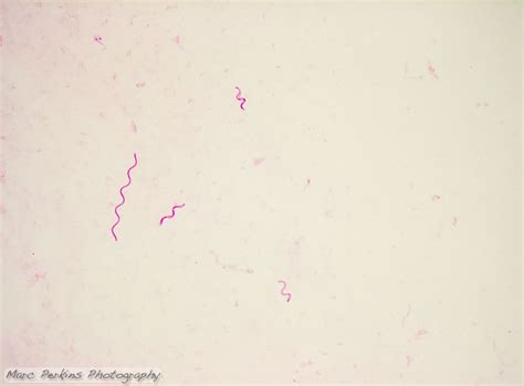 Bacterial Cells Under Microscope 400x