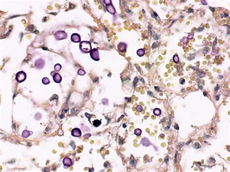 Cryptococcus Sp Control Histology Slides