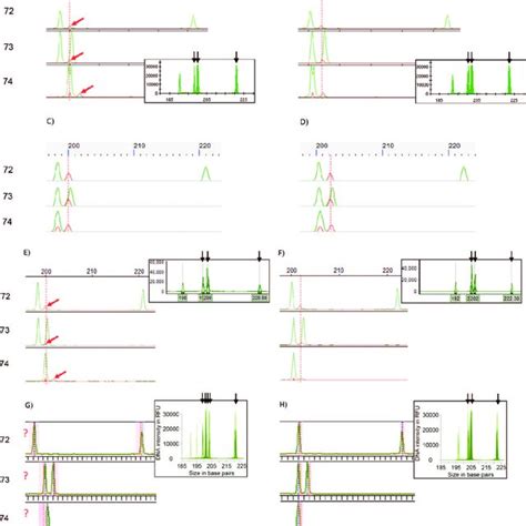 Electropherograms Showing Alleles Green Peaks With Hex Luorescent Dye