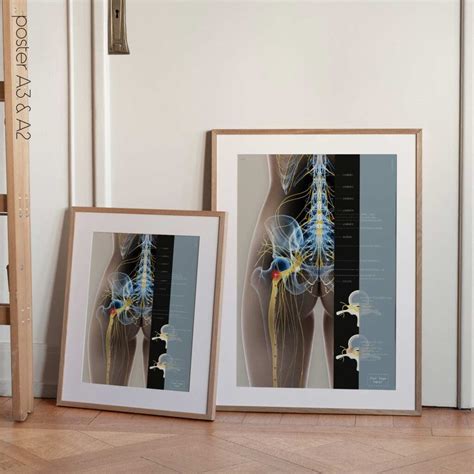 Sciatica And Stenosis Educaredesign