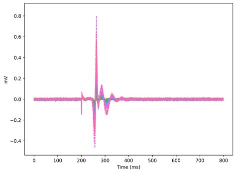 Github Jasmineherszage Emg Analysis Of Emg Recordings Of Motor Evoked Potentials Induced By