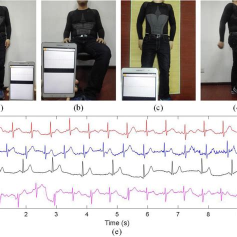 Pdf Design Of A Smart Ecg Garment Based On Conductive Textile