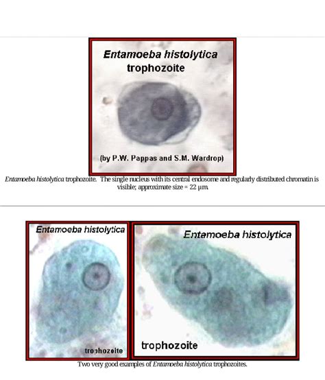 Entamoeba Histolytica Morphology