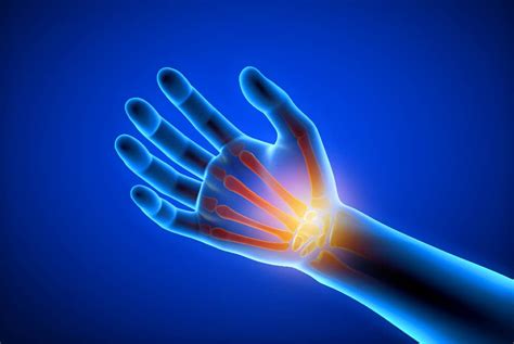 Ulnar Sided Wrist Pain Orthopaedic Research UK