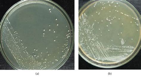 Streptococcus Lactis Colony Morphology