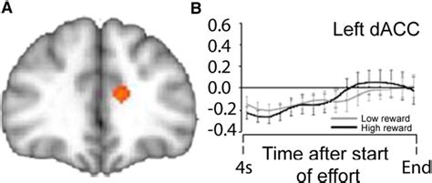 Figure 1 From Frontal Cortex And Reward Guided Learning And Decision