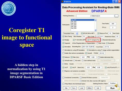 Ppt Data Processing Of Resting State Fmri Part 3 Dparsf Advanced Edition Powerpoint