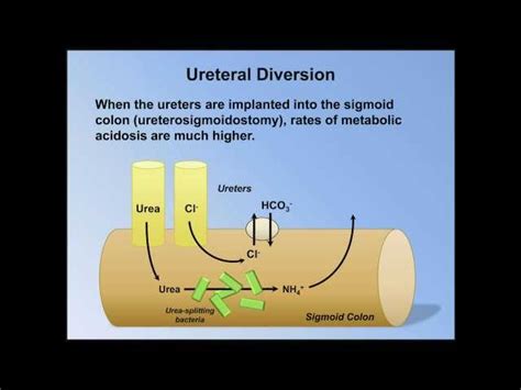Free Video Normal Anion Gap Metabolic Acidosis ABG Interpretation From Strong Medicine