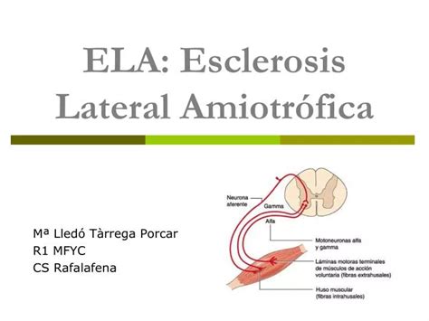 Ppt Ela Esclerosis Lateral Amiotrófica Powerpoint Presentation Free